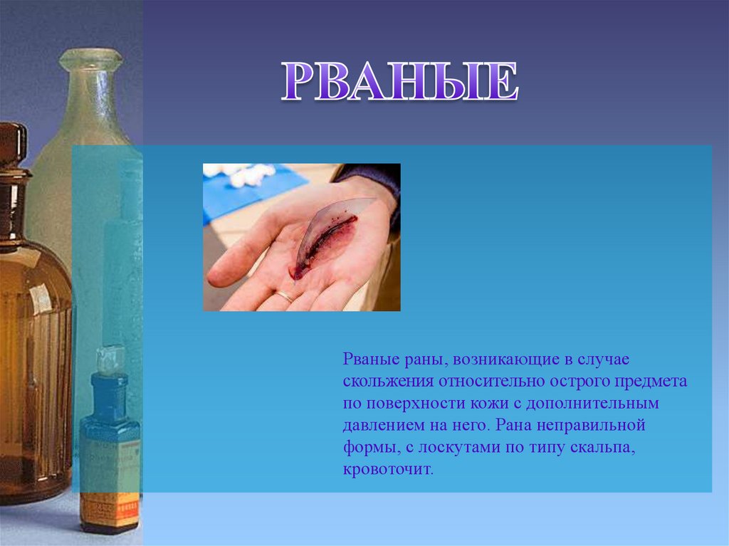 Виды ран - презентация онлайн