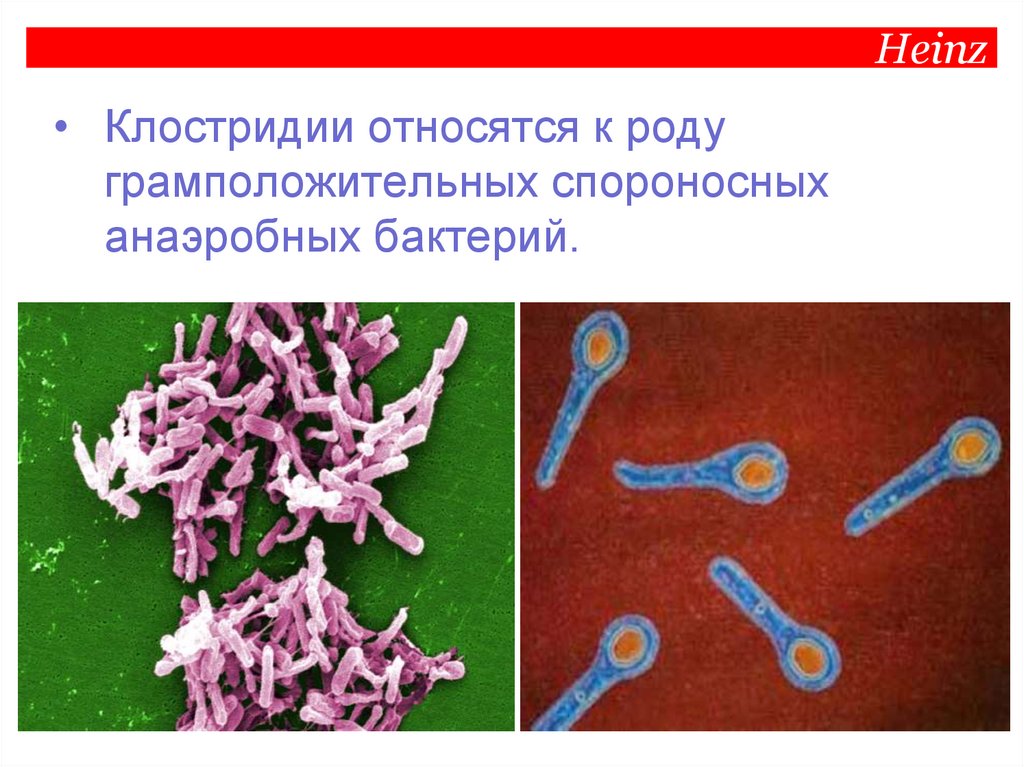 Сульфитредуцирующие клостридии (Clostridia) - презентация онлайн