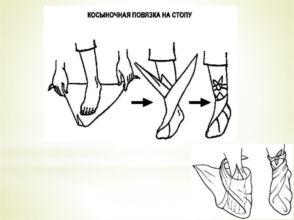 Освоение техники наложения косыночных повязок - online presentation