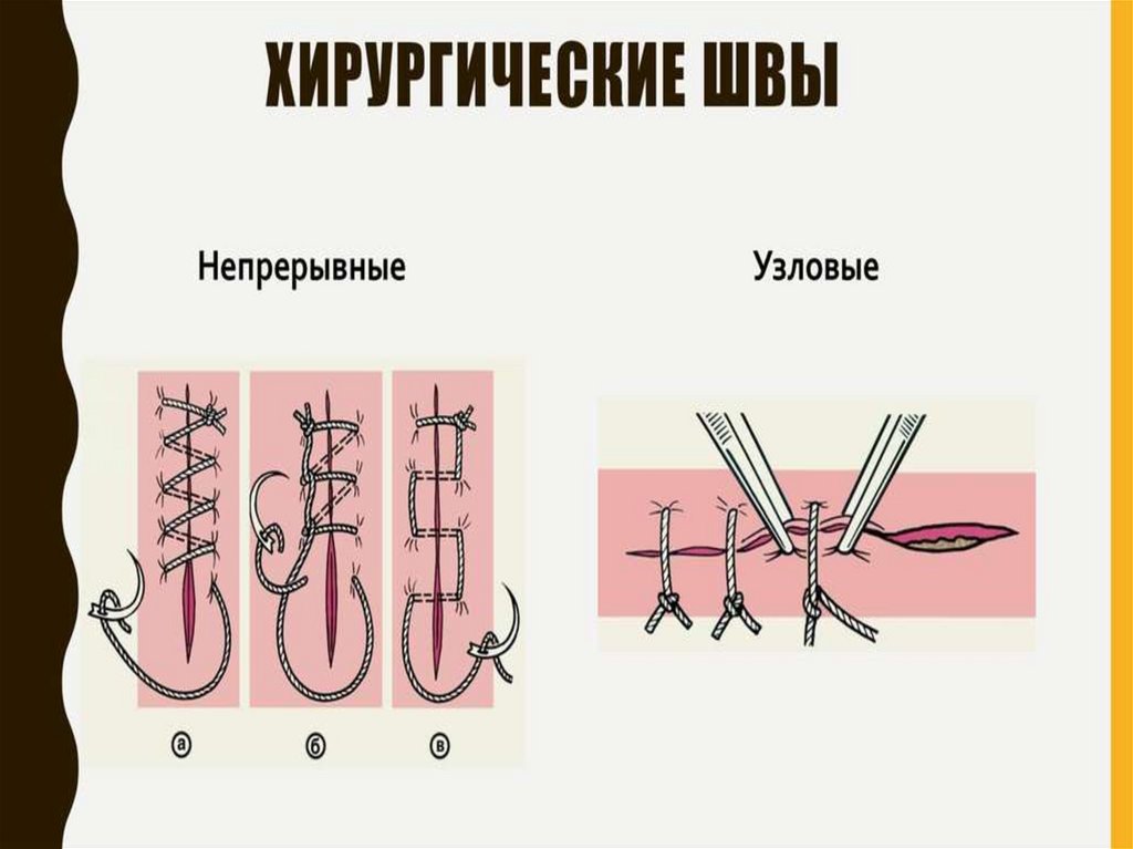 Основные хирургические навыки. Лекция 1 - online presentation