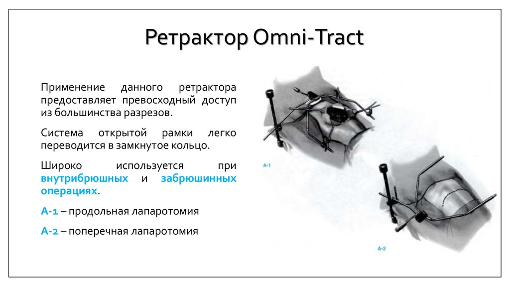 Ретракторы и принципы экспозиции - презентация онлайн