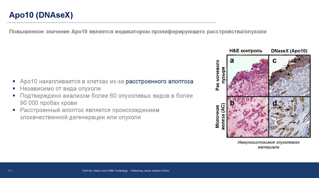 PanTum Detect and EDIM Technology – выявление рака на ранних стадиях ...