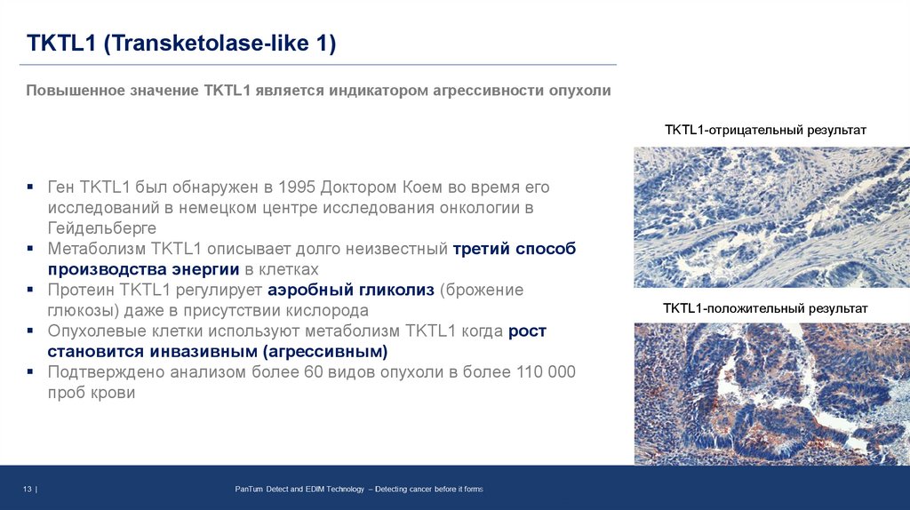 PanTum Detect and EDIM Technology – выявление рака на ранних стадиях ...